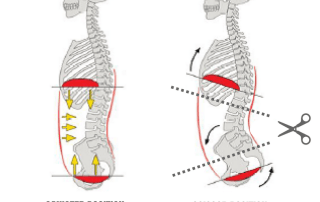 Intra-Abdominal Pressure (IAP): What is it? How to engage the core to ...
