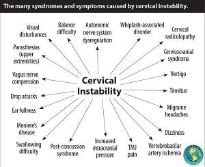 Cervical Instability: The Hidden Cause Behind Your Chronic Neck Issues ...